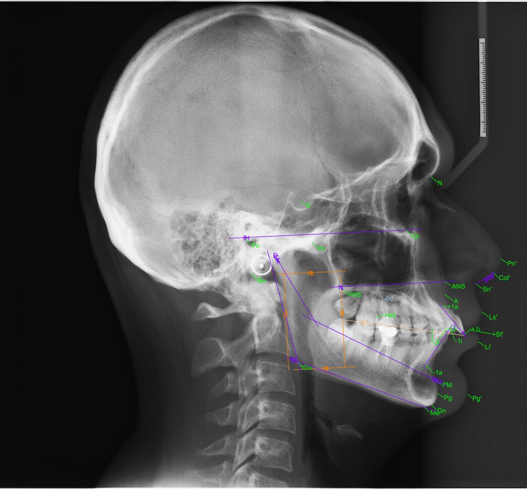 DIAGNÓSTICOS – Digital Panorex